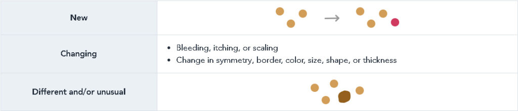 Atypical / Dysplastic Mole-test | SkinIO