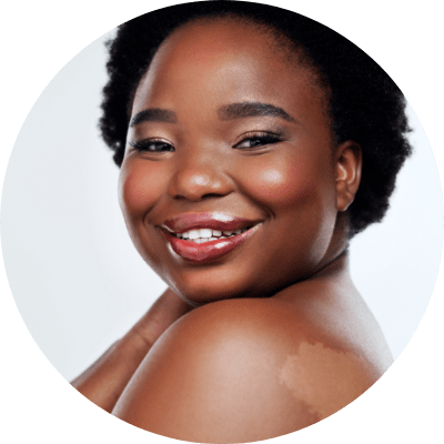 For Employers | SkinIO